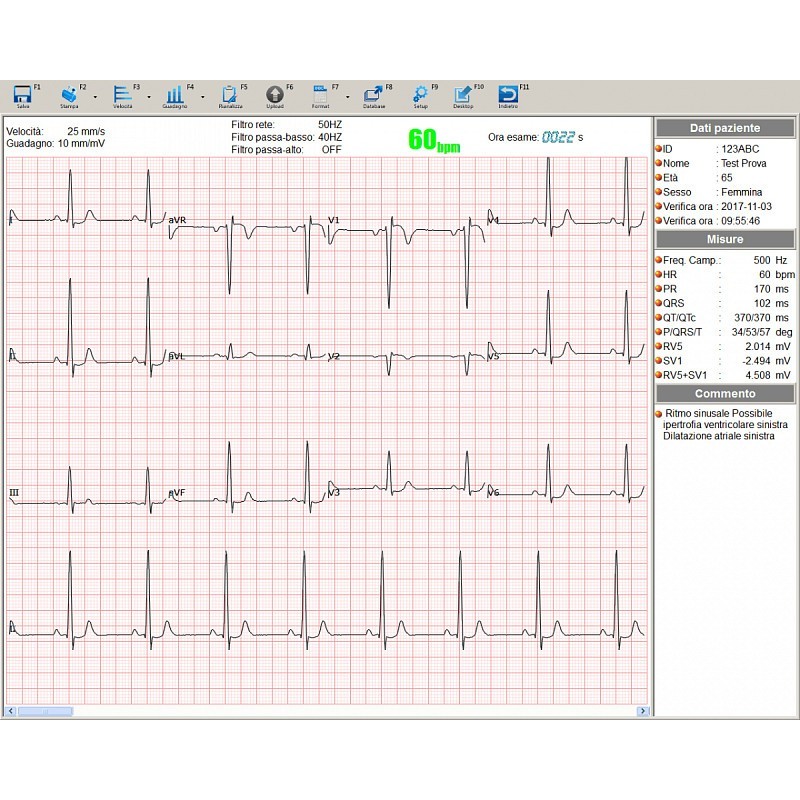 Wireless pc-ecg electrocardiograph euro ecg bt12